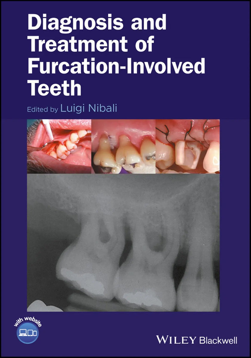 Diagnosis and treatment of furcation-involved teeth 2018 – MedSTA